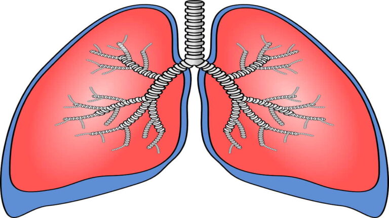 Plućni infarkt (infarctus pulmonis) - Svet Medicine